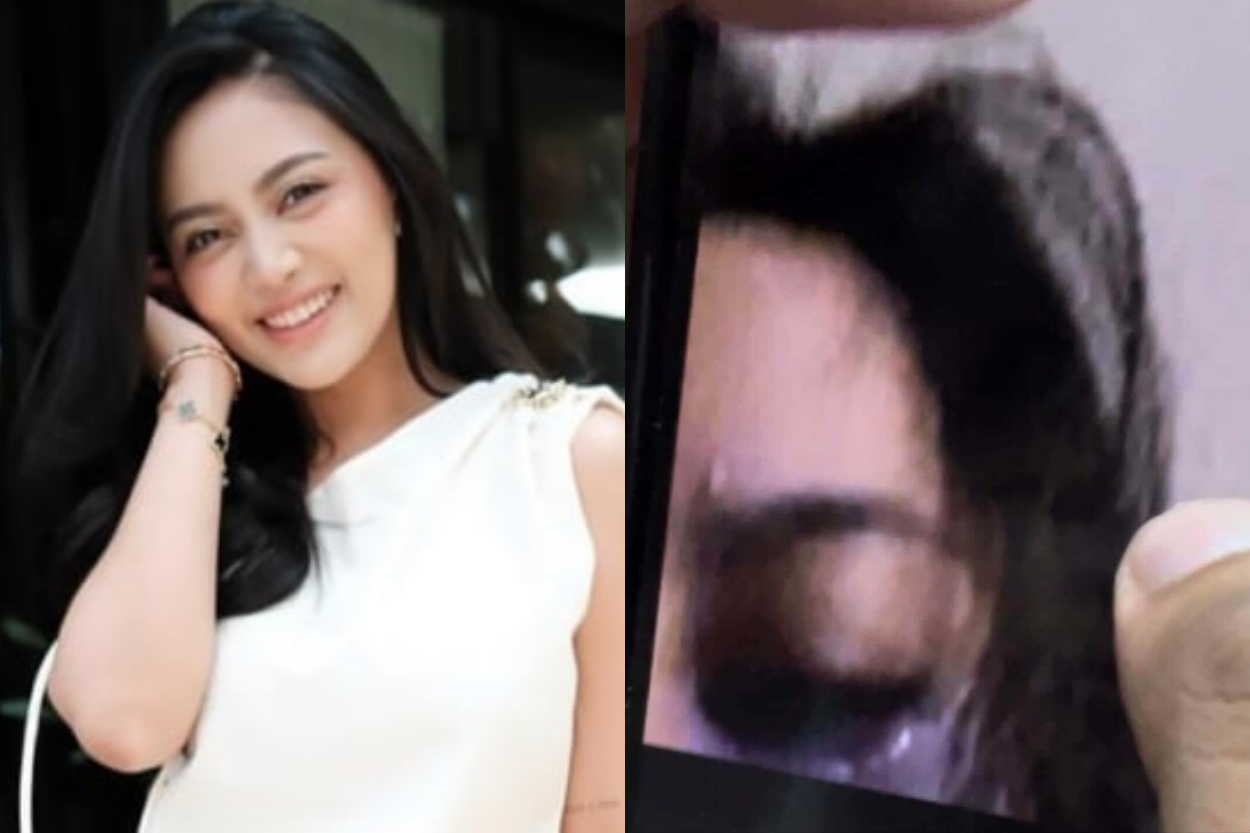 Rachel Vennya Pamer Mata Lebam, Dibogem Okin?