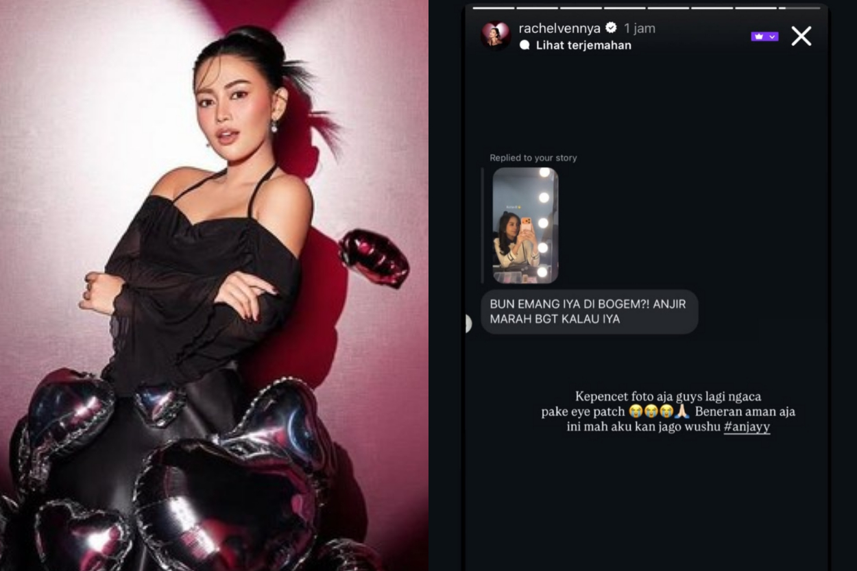 Rachel Vennya Klarifikasi Mata Lebam, Bukan Ditonjok Okin?