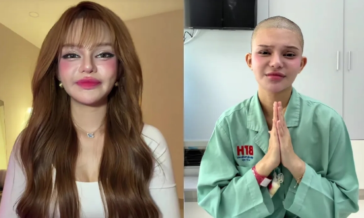 Viral Influencer Vietnam Derita Kanker Darah Usai 3 Tahun Ogah Minum ...